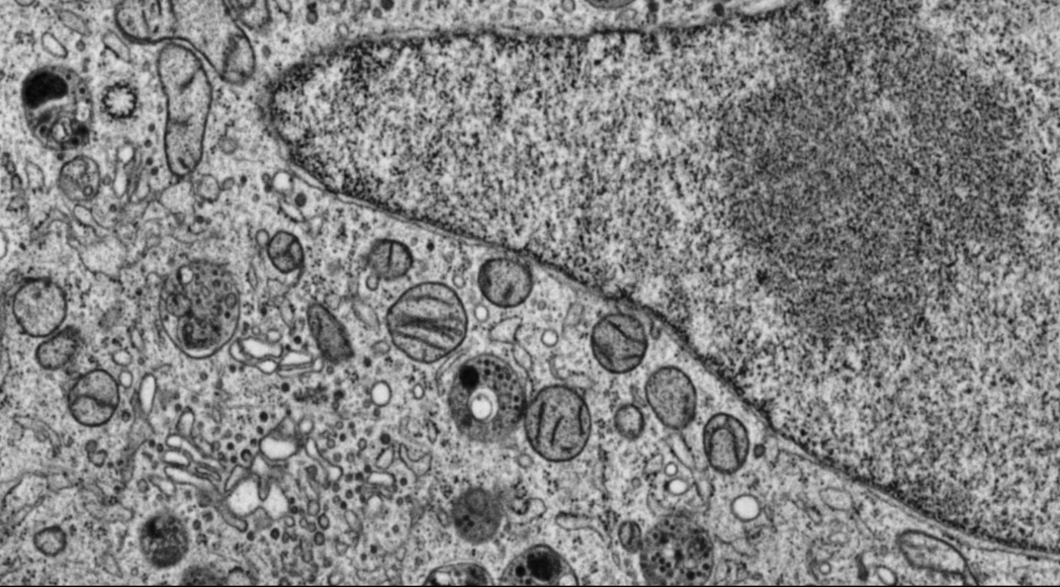 Cryo-FIB Milling for Lamella Preparation – EMBL Imaging Centre