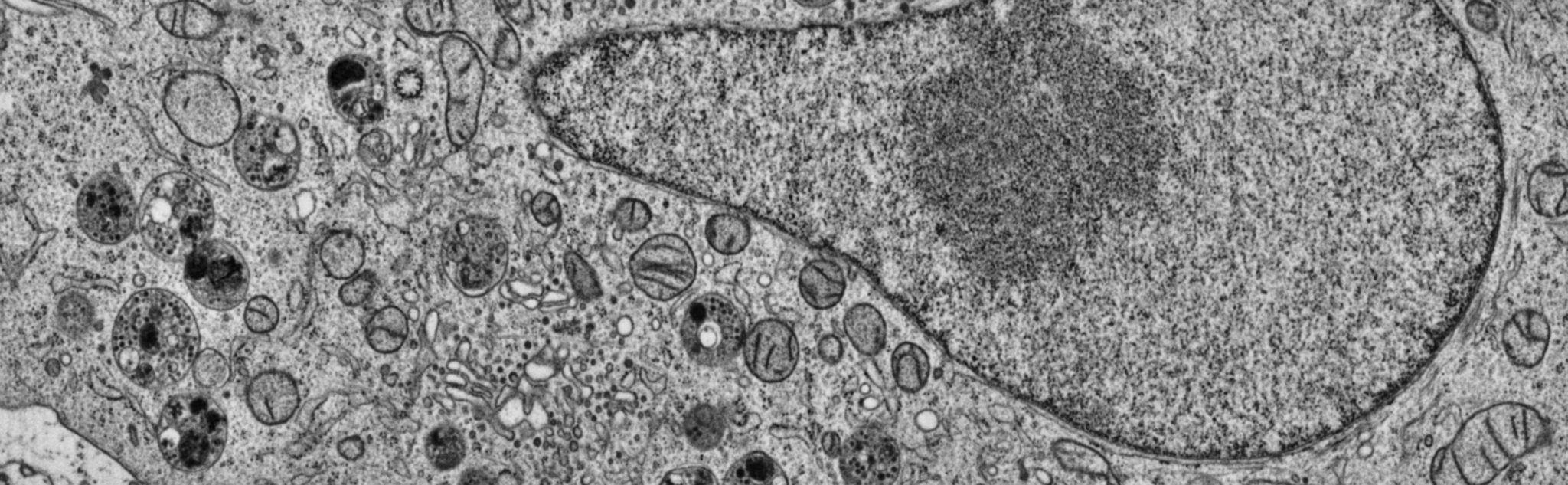 Electron Microscopy Services – EMBL Imaging Centre
