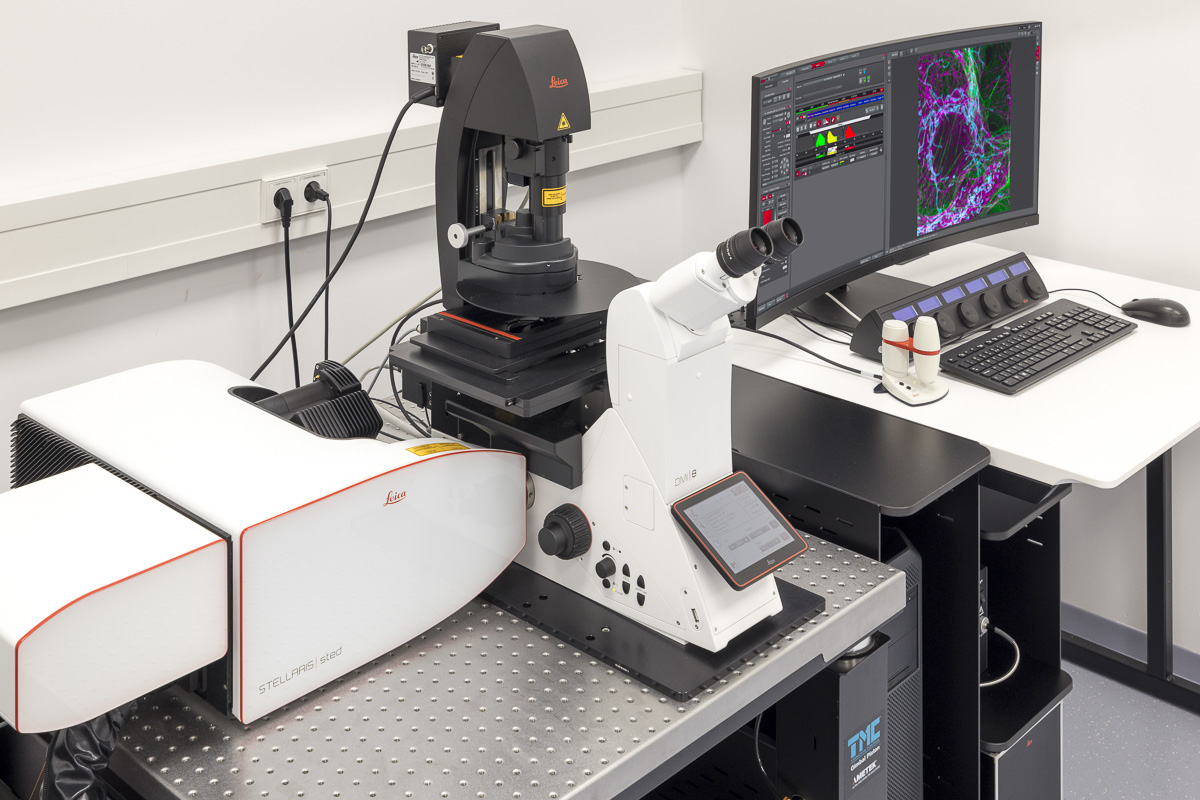 Stimulated Emission Depletion (STED) Microscopy – EMBL Imaging Centre