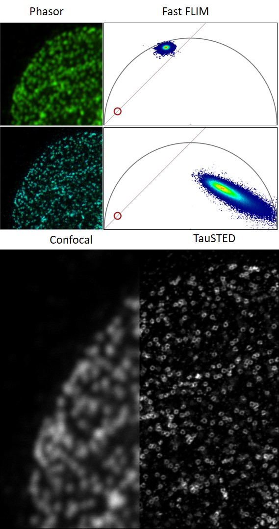 Stimulated Emission Depletion (STED) Microscopy – EMBL Imaging Centre