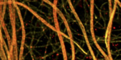 Upcoming Courses and Workshops – EMBL Imaging Centre