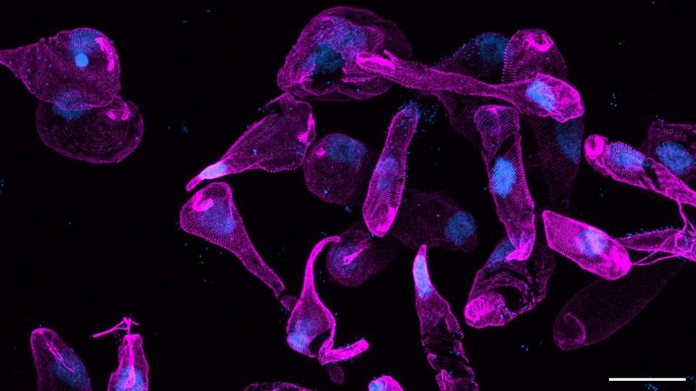 PlanExM – Planetary Biology