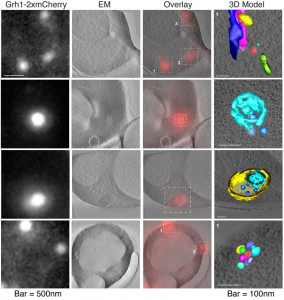 Correlative Light and Electron Microscopy (CLEM) – Electron Microscopy ...