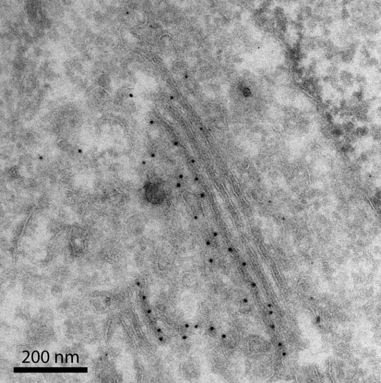 Immuno Labeling For Em Electron Microscopy Core Facility