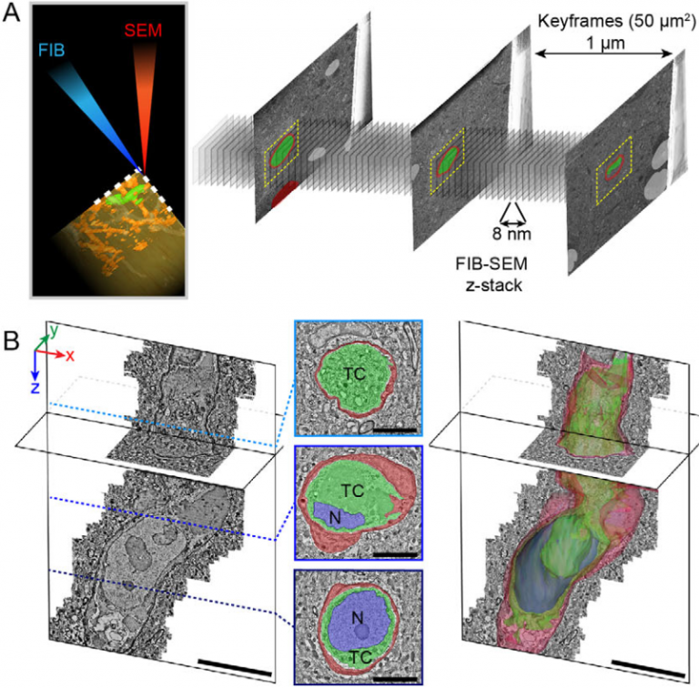 Focused Ion Beam milling combined with Scanning Electron Microscopy (FIB-SEM) – Electron ...