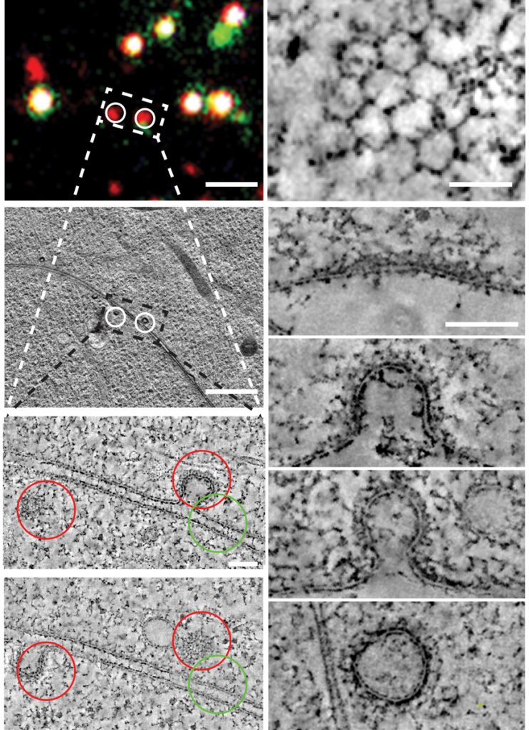 Electron Microscopy Core Facility – The facility provides advanced expertise in electron ...