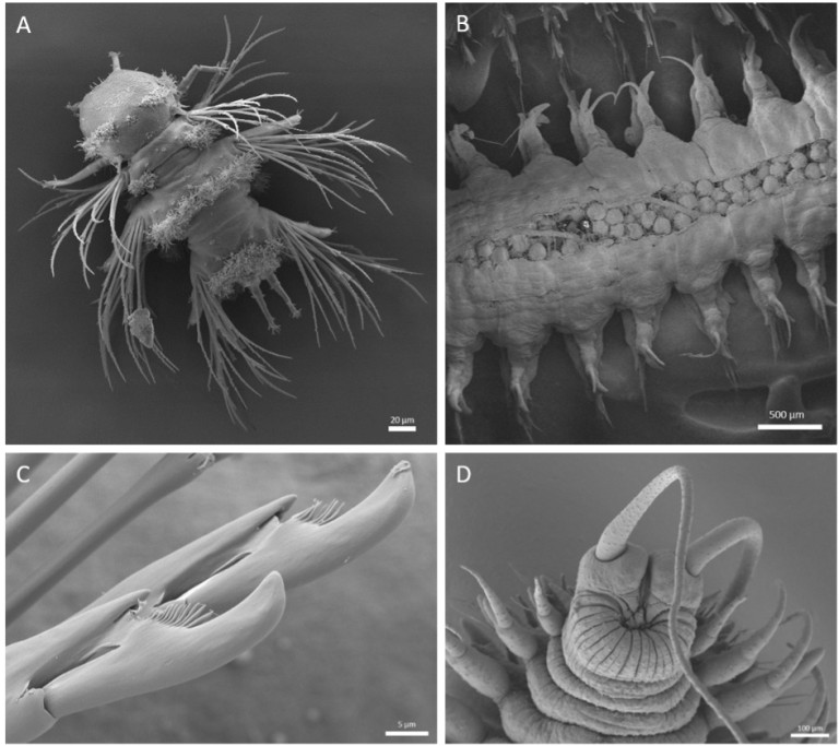 Scanning Electron Microscopy (SEM) – Electron Microscopy Core Facility Scanning Electron Microscopy (SEM) – Electron Microscopy Core Facility
