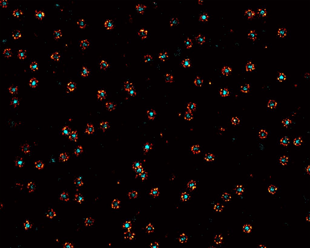 New perspectives on nuclear pores | EMBL