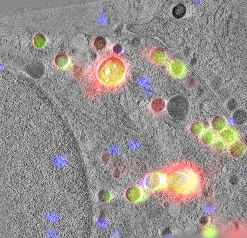 EMBL makes insulin visible | EMBL