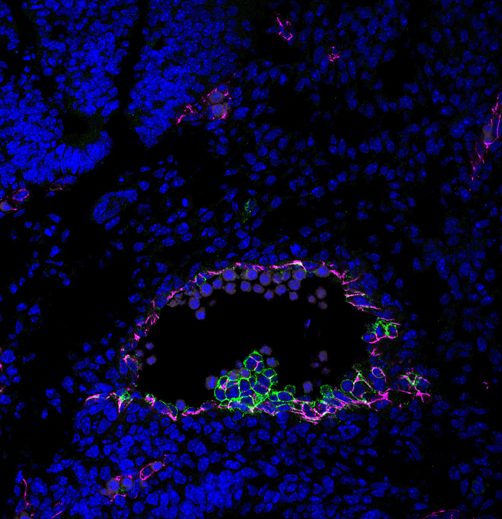 From cosmetics to blood cells | EMBL