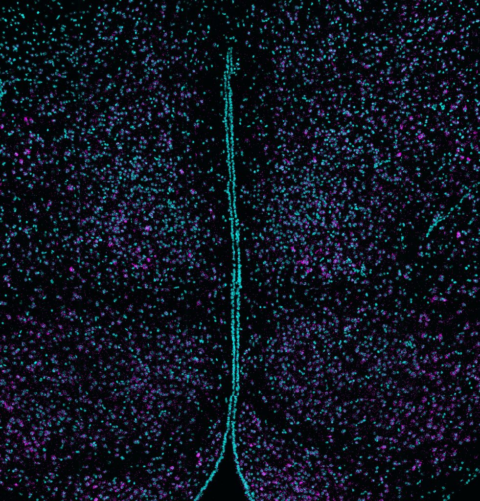 Beyond the lens – microscopy at EMBL Rome | EMBL