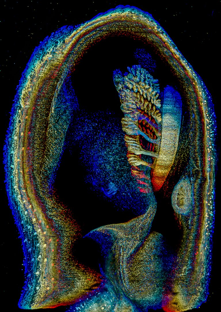 The secret life of baby octopuses | EMBL