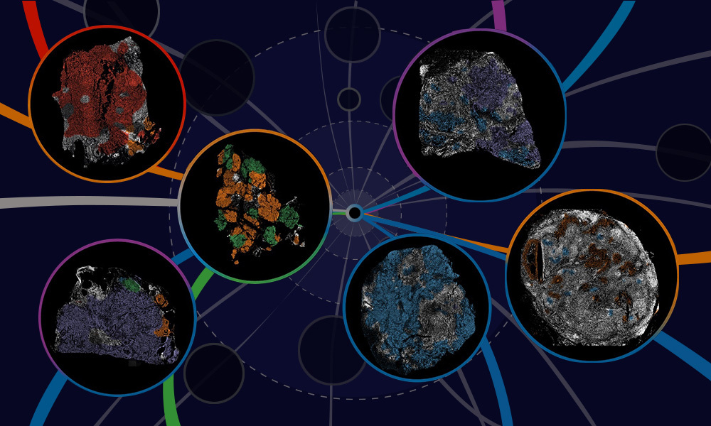 New molecular microscopy uncovers how breast cancer spreads | EMBL New molecular microscopy uncovers how breast cancer spreads | EMBL