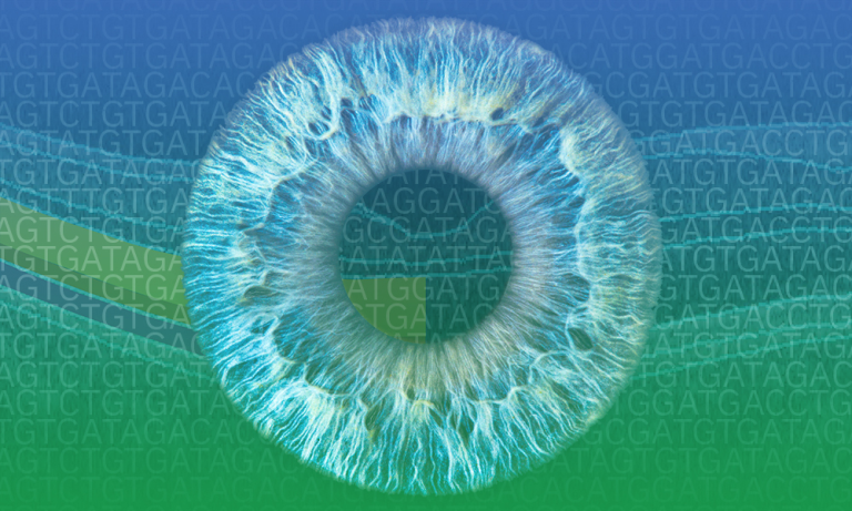 Large-scale study enables new insights into rare eye disorders | EMBL