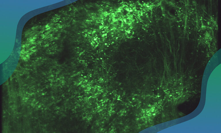 The MANE collaboration: working together to support genome science | EMBL